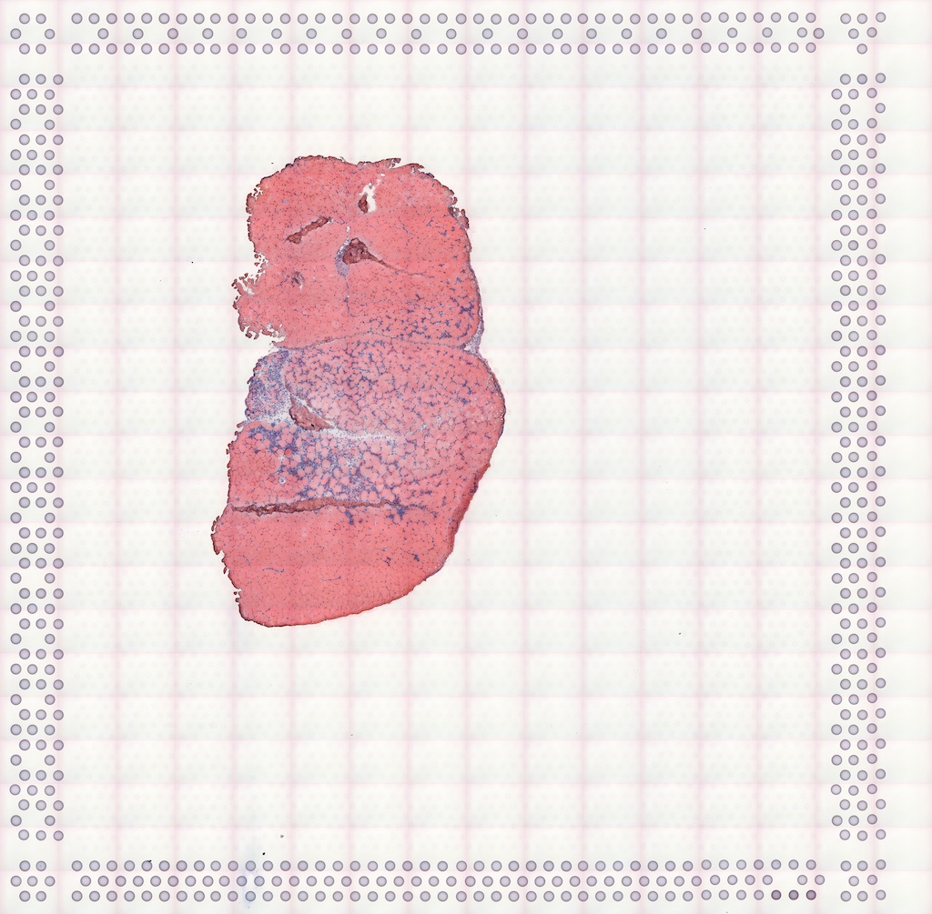 Spatial Visium exploratory data analysis • Voyager