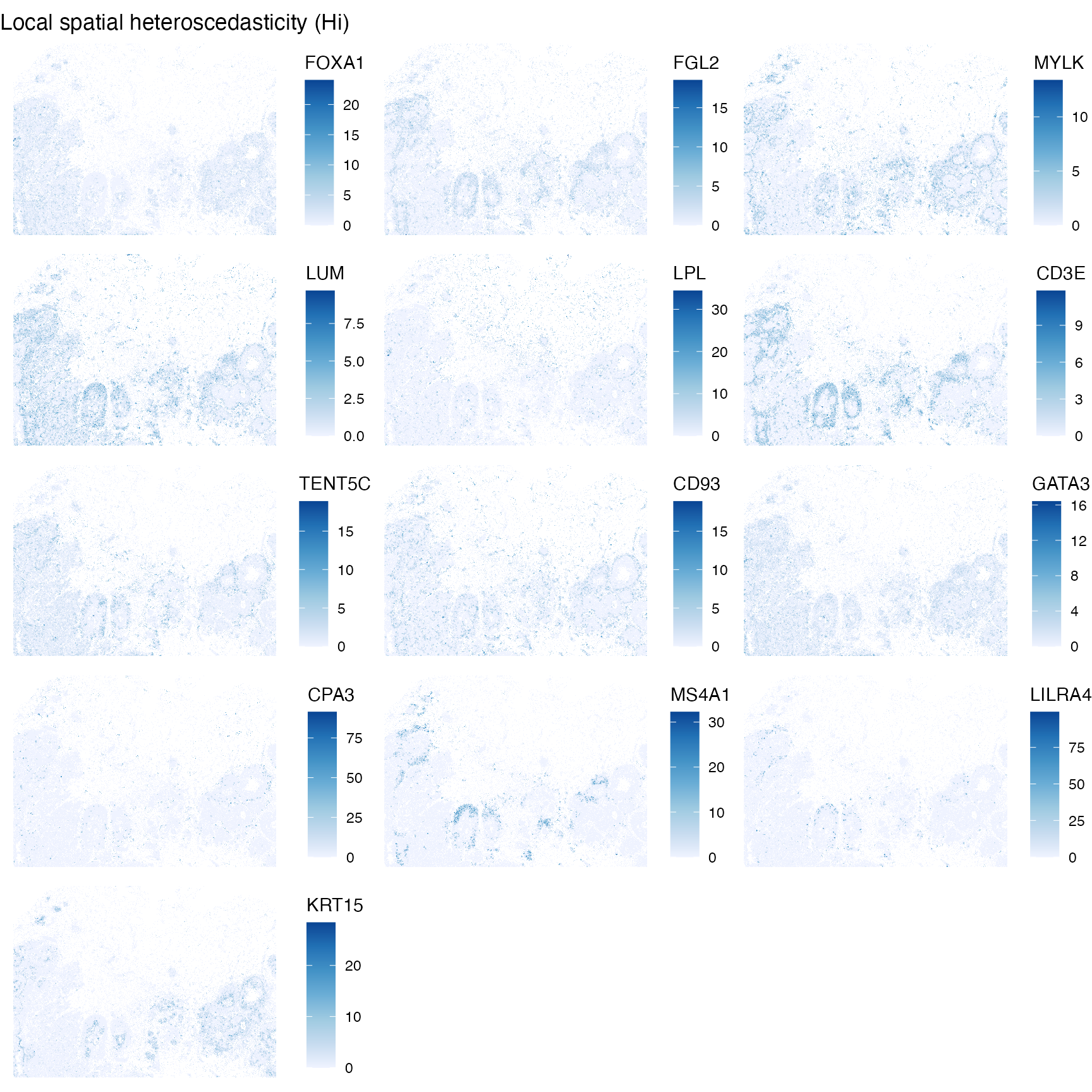 Xenium breast cancer dataset • Voyager